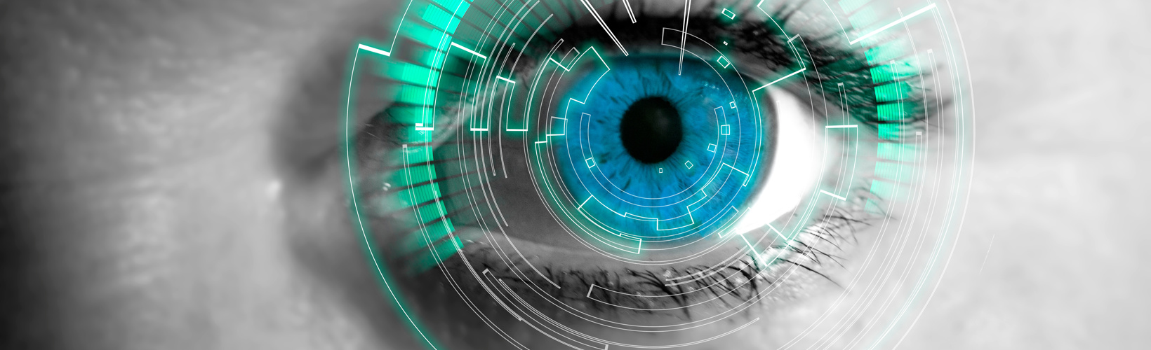 ESCRS - FS-LASIK For The Treatment Of Moderate To High Hyperopia